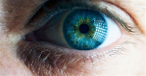 Malignant Melanoma Eye