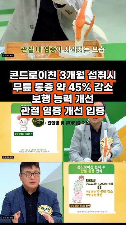 65세 이상 관절염 유병률 37 8 우리 부모님은 콘드로이친 관절염치료 관절영양제 관절통증 Youtube