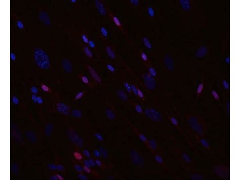 Human Anti Sox10 Antibody Af2864 Randd Systems