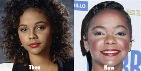 Lark Voorhies Plastic Surgery Before And After Photos Latest Plastic