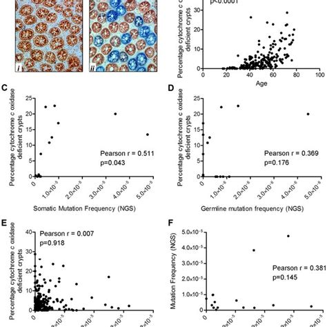 Proposed Model Of Mitochondrial Dysfunction In Aging Toxic Ros