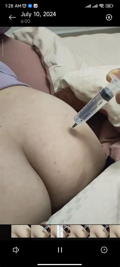 Butt Injection Video 46