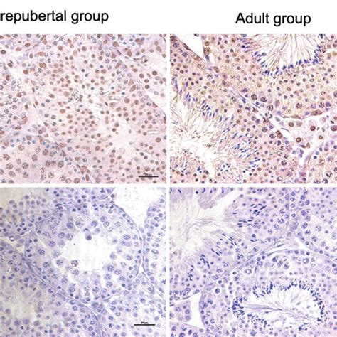 Cellular Localization And Qualitative Comparison Of Set Expression In