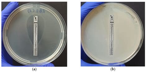 The Emergence Of Antimicrobial Resistance And Virulence Characteristics