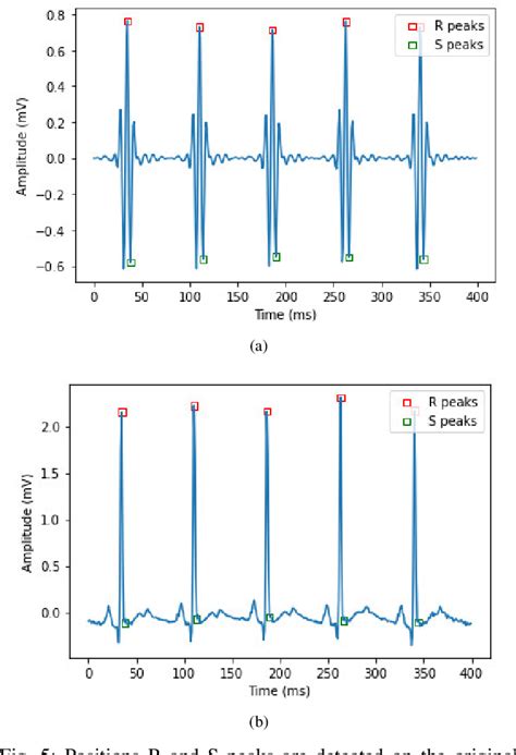 Figure 5 From A Novel Deep Learning Based Approach For Sleep Apnea Detection Using Single Lead