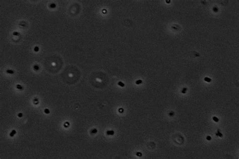 Detection Bacter Gray Object Detection Dataset And Pre Trained Model By