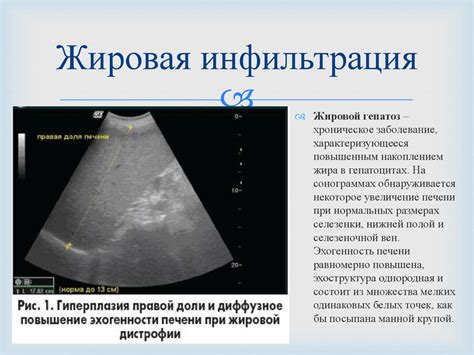 Лучевая диагностика диффузных поражений печени презентация онлайн