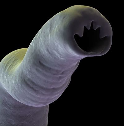 Hookworm Infections Bunostomiasis