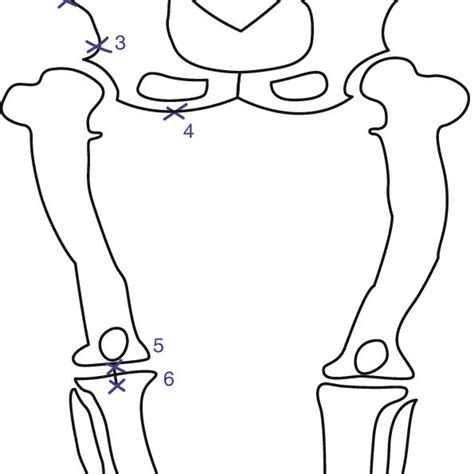 Apophysitis Locations 1 Iliac Crest 2 Anterior Superior Iliac Download Scientific Diagram