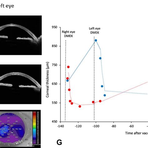 Composite Showing A Swept Source Optical Coherence Tomography Download Scientific Diagram