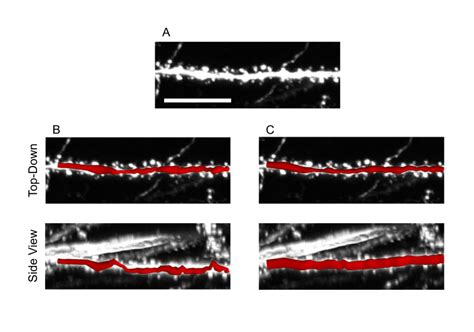 Dendritic Spine Quantification Using An Automatic Three Dimensional Neuron Reconstruction