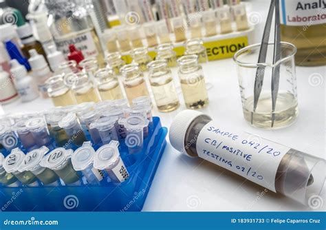 Samples Contaminated By Clostridium Botulinum Toxin That Causes Botulism In Humans Laboratory
