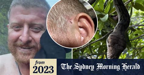 Video Cairns Hiker Shares Bloody Pictures After Being Attacked By