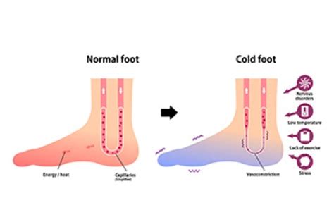 Scleroderma And The Feet Blog