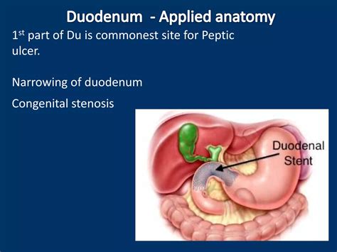 Anatomy Of Duodenum Duodenum Structure Ppt Of Duodenum Power Point Presentation Duodenum Pptx