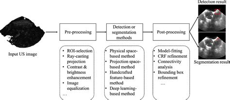 Systematic Pipeline Of Instrument Detection In Us Image First The Download Scientific Diagram