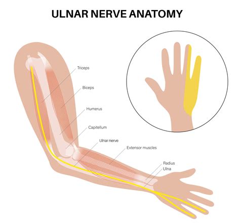 Ulnar Nerve Causes Ulnar Nerve Subluxation Clinical Anatomy Kenhub