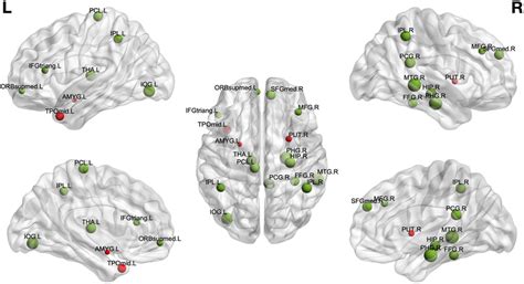 Brain Glass‐surface Representation Of The Partial Least Squares