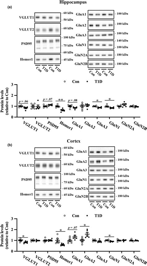 Expression Levels Of Excitatory Synapse Proteins In The Hippocampus And