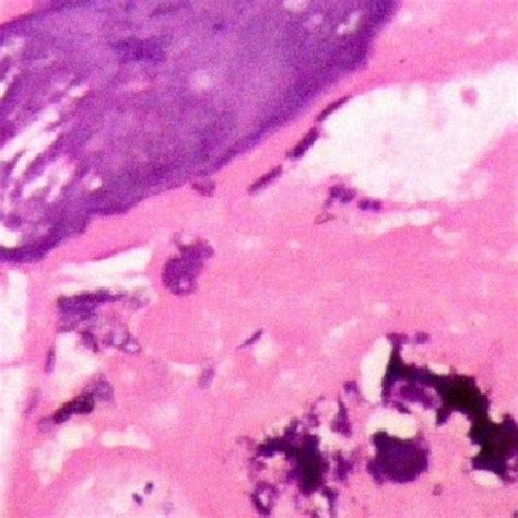 Photomicrograph 10x H Ande Showing Calcification In Postmature Placenta Download Scientific Diagram