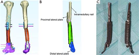 Design And Structure Of The Prosthesis A Through The Download