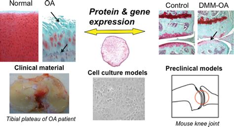 Chondrocyte Hypertrophy Semantic Scholar
