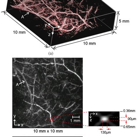 Photoacoustic Image Of The Vasculature In The Skin Around The Abdomen Download Scientific