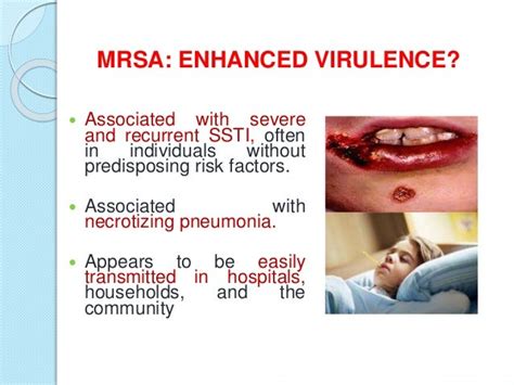 Mrsa An Update