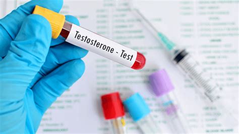 Testosterone Levels Private Blood Tests