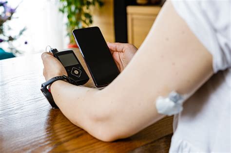 현대 당뇨병 치료 여성은 포도당 수준을 확인하고 인슐린 펌프와 원격 센서를 사용하여 인슐린을 투약 배경에 초점을 맞추고 인슐린 펌프에 대한 스톡 사진 및 기타 이미지