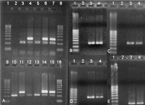 Embryo Sex Determination And Es Like Colonies Gene Expression A