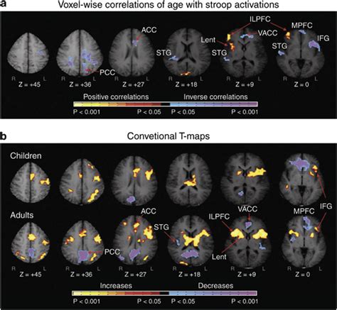 Development Of Neural Circuits For Cognitive Control Images Represent