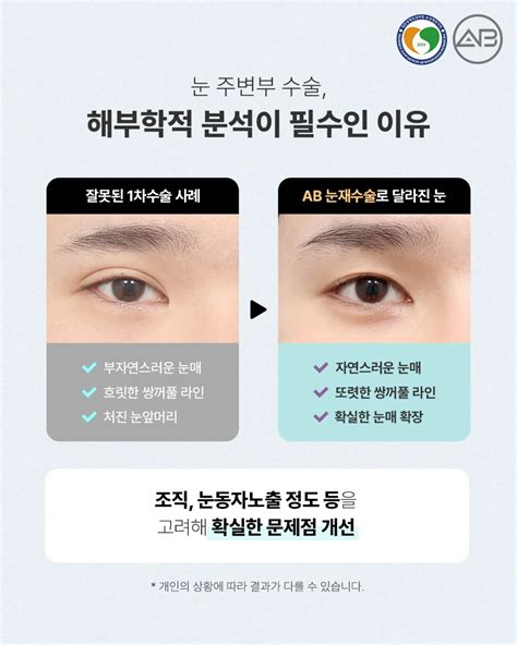 에이비성형외과 Ab 맥미걸 Awards 🏆 당신의 최애 맥미걸은 누구인가요 Ab 맥미걸들의 놀라운 변화 그중에서 가장 눈에 띄는 맥미걸은 누구인가요💖 나도