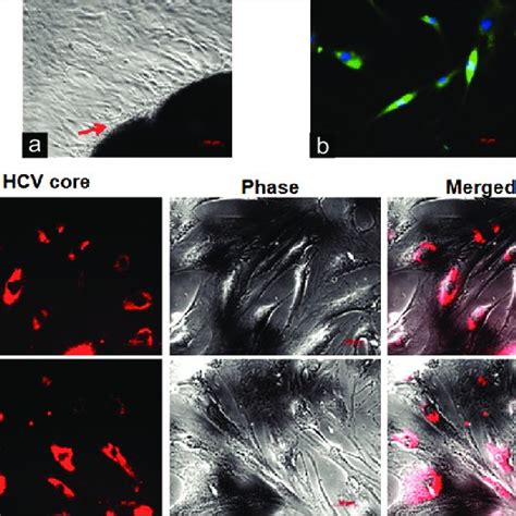 Hepatitis C Virus Core Protein Internalisation By Human Conjunctival