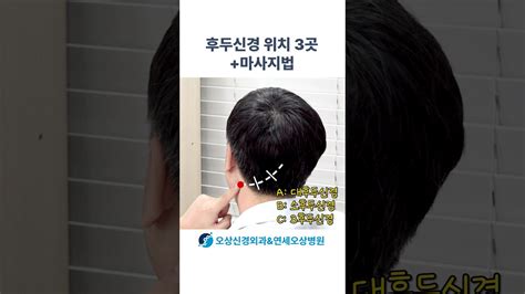 병원 안 가고 두통안면통증 해결하는 후두신경 마사지 Shorts Youtube