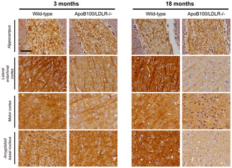 Map2 Staining In Young And Aged Wild Type And Transgenic Mice Map2 Download Scientific Diagram