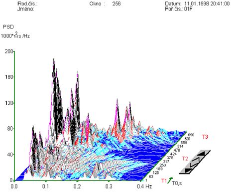 Control The Results Of Spectral Analysis Of Heart Rate Variability Download Scientific