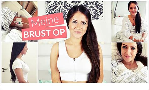 Meine Brust Op Bilder Brustvergrößerung Erfahrungen Schönheits Op Vorher Nachher Teil 12