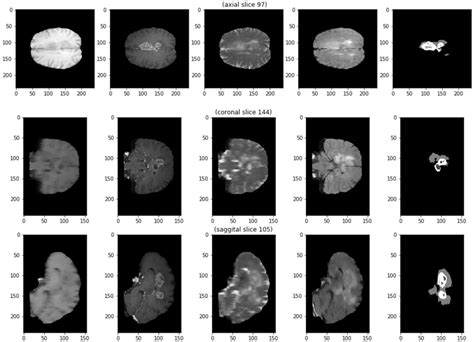 Convolution Neural Networks For Semantic Segmentation Application To Small Datasets Of