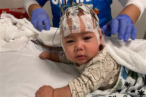 Neurogenetic Disorders