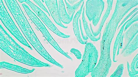 Transversal Section On Pinus Leaf Filmed Under Microscope With 40x Magnification On Bright Field