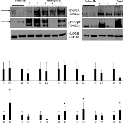 Prb And Phosphorylated Prb Pprb Expression Levels In Bladders Of Download Scientific Diagram