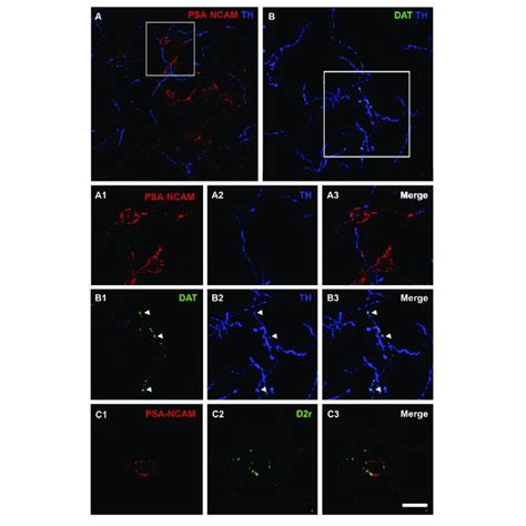 Psa Ncam Expressing Cells In The Rat Piriform Cortex Download