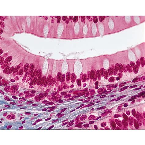 Example Of Simple Columnar Cell At Samantha Wendt Blog