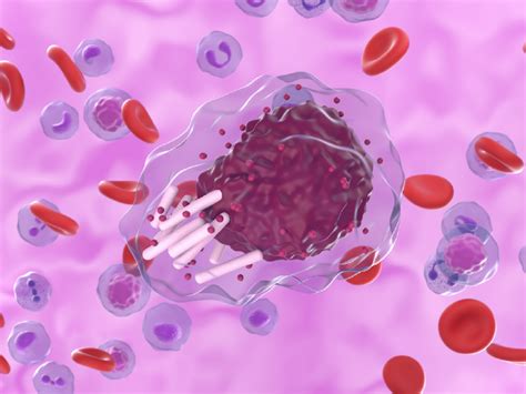 Optimizing Treatment Of Cllsll Expert Guidance On Application Of The