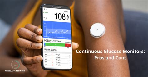 What Is A Continuous Glucose Monitor