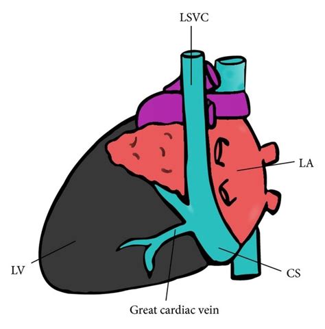 A Schematic Diagram Demonstrating Normal Venous Return To The Right Download Scientific