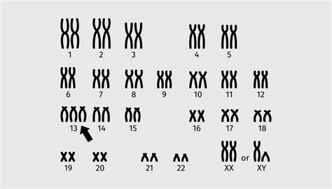 Кариотип что это такое