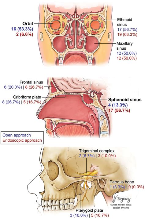 Anterior Skull Base Anatomy 668x669