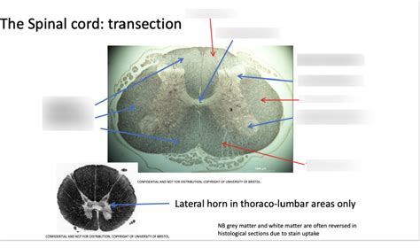 Diagram Of Transection Of Spinal Cord Quizlet